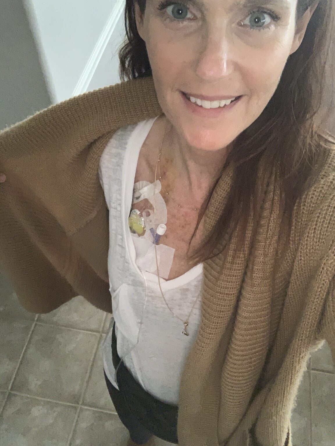 Folfox Chemotherapy for Colon Cancer: What to Expect - Living46